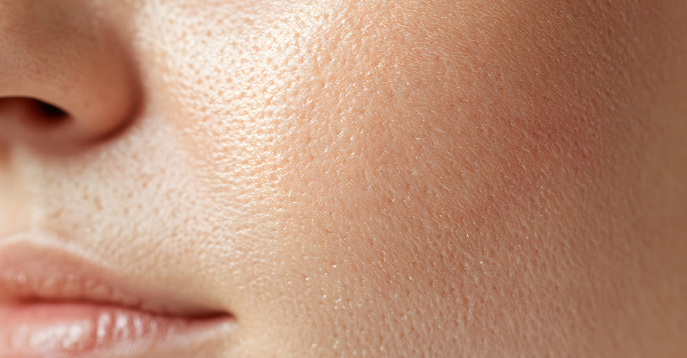Fettige Haut – phc skincare
